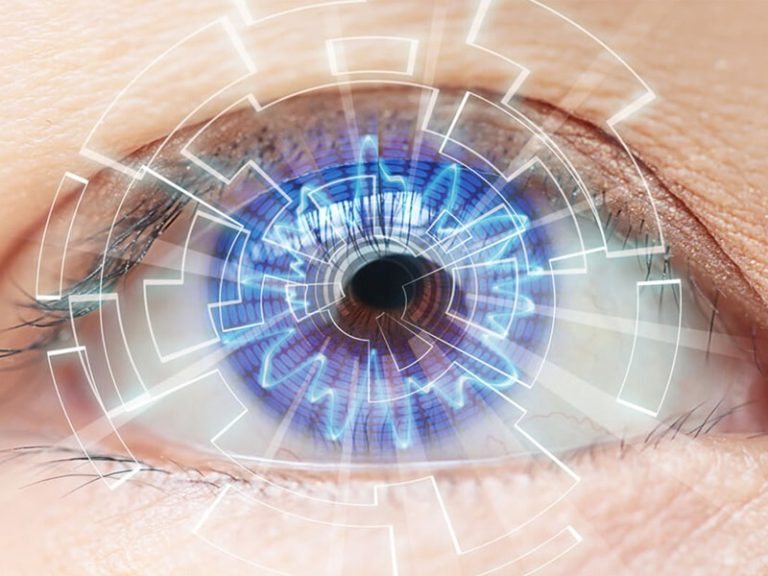 No-Touch Laser – Este Expert